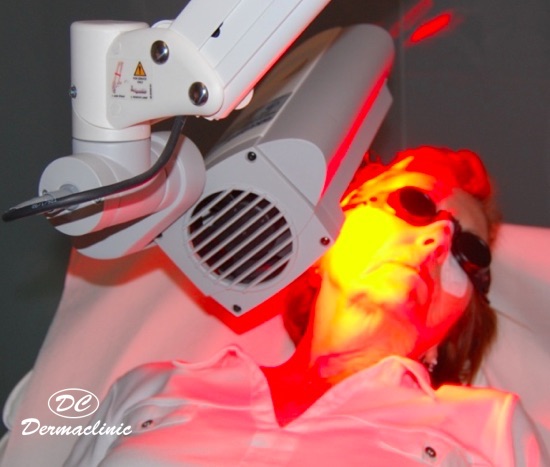 Terapia Fotodinámica Dermaclinic